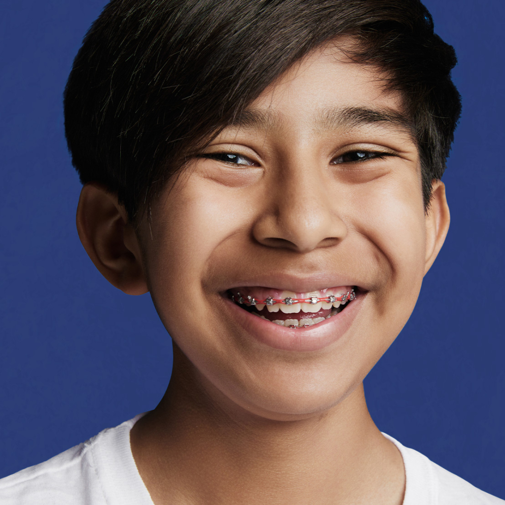 Invisalign® Treatment and Braces | Shoreview Orthodontics