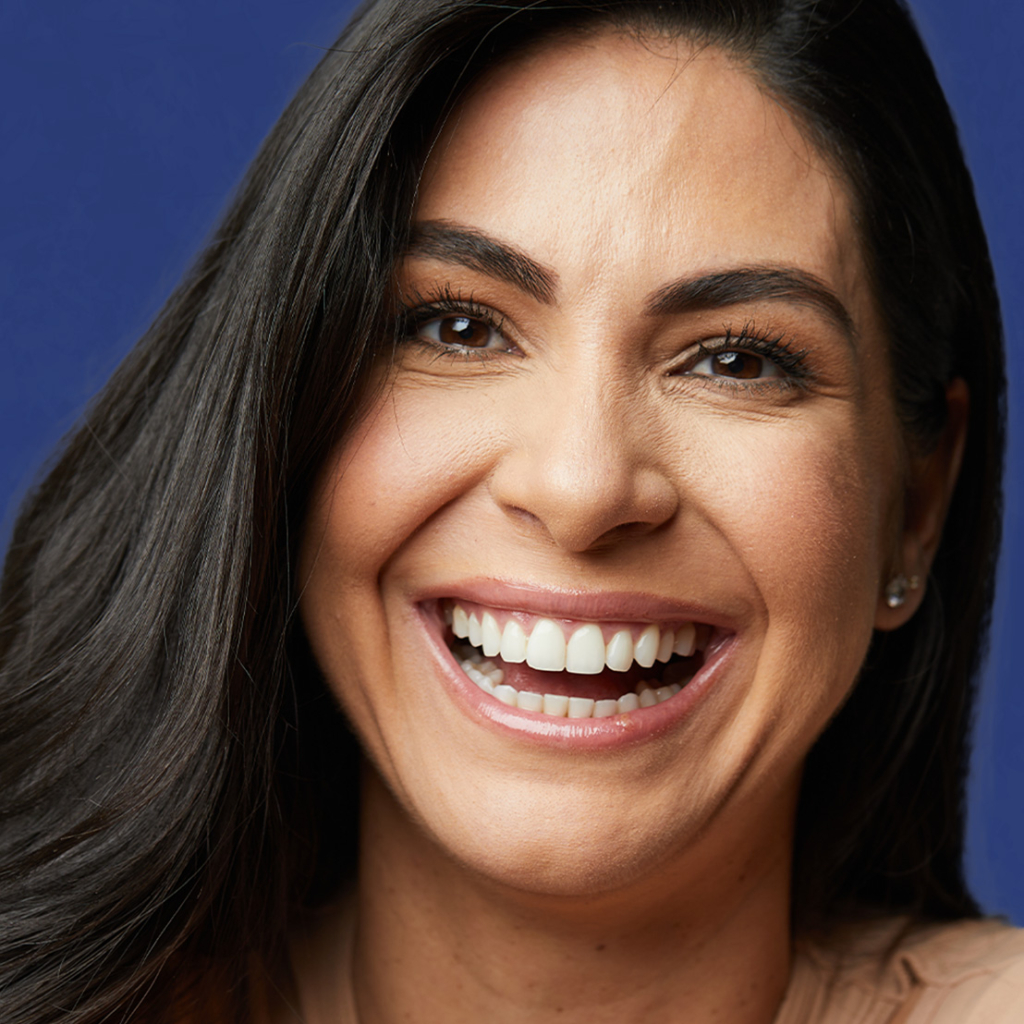 Invisalign Results After 6 Months! | Smile Express® At-Home Aligners